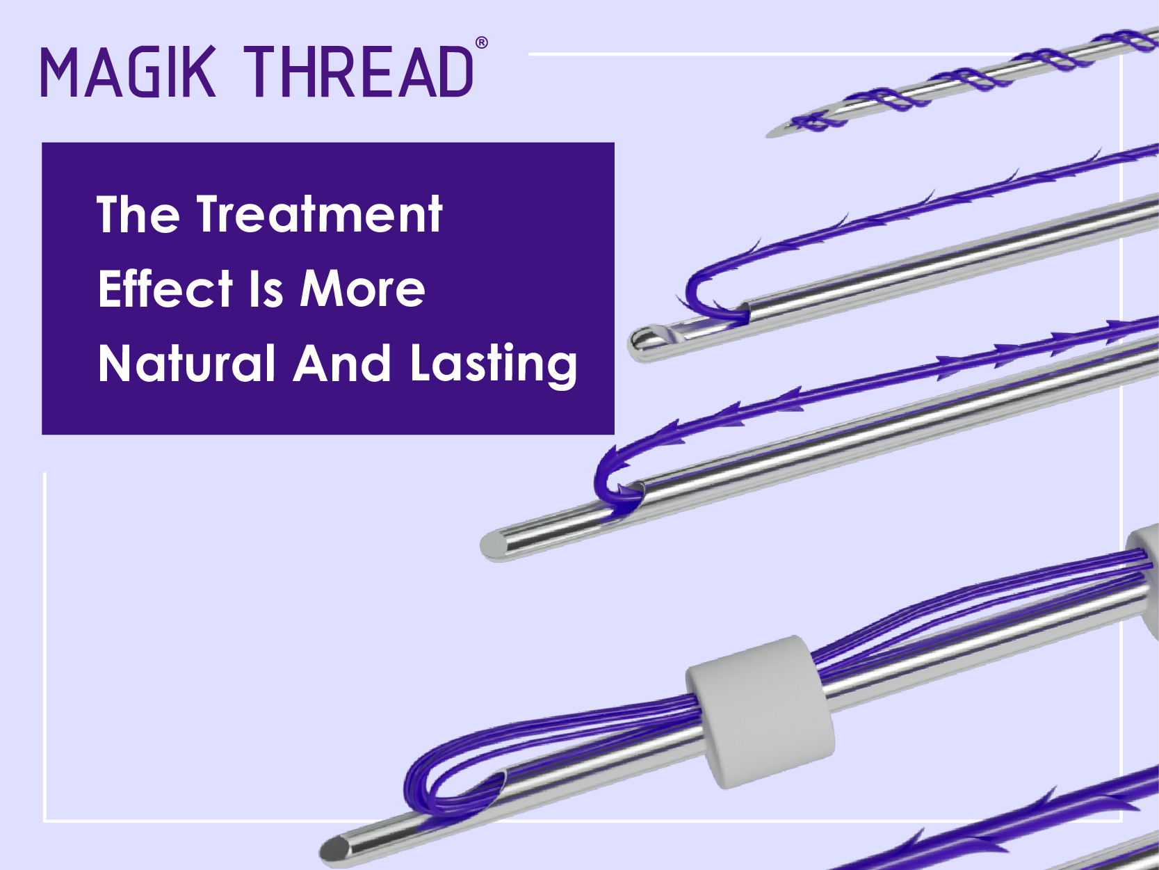 face pdo thread lift - Dermax