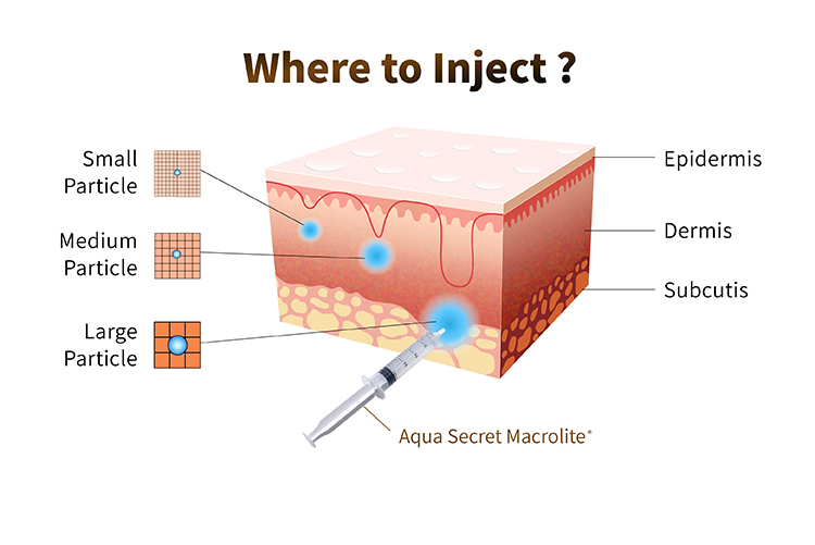 injection breast dermal filler, Buy injection breast dermal filler ...